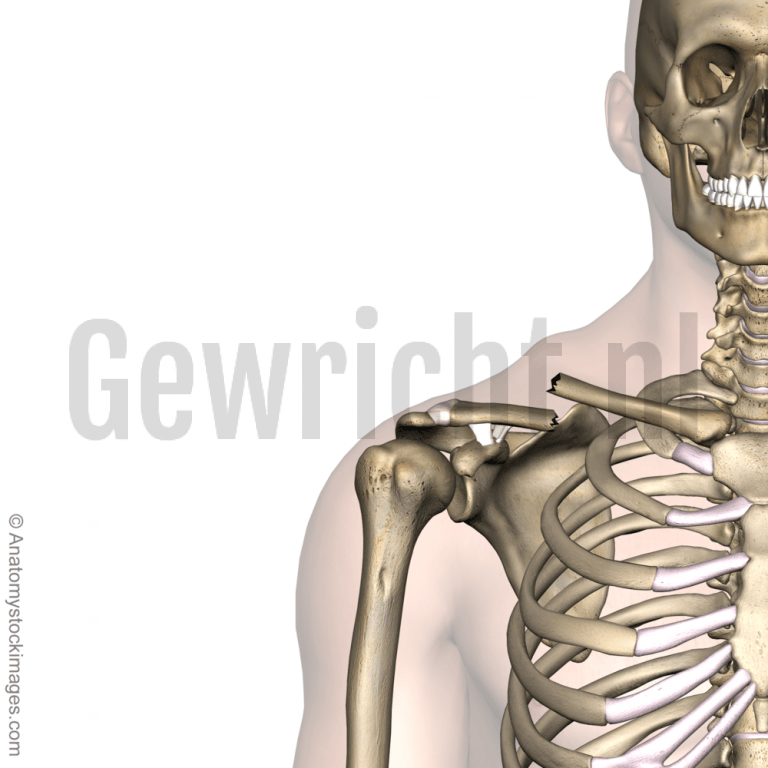 shoulder-clavicula-fracture-clavicle-broken-collarbone-front-skin ... shoulder-clavicula-fracture-clavicle-broken-collarbone-front-skin ...