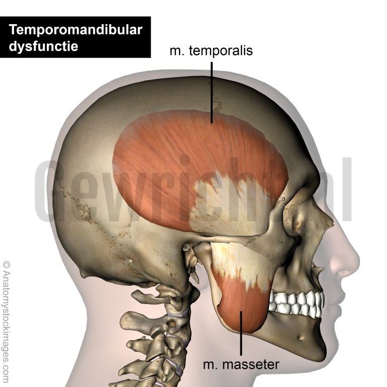 Gespannen spieren - GEWRICHT.nl